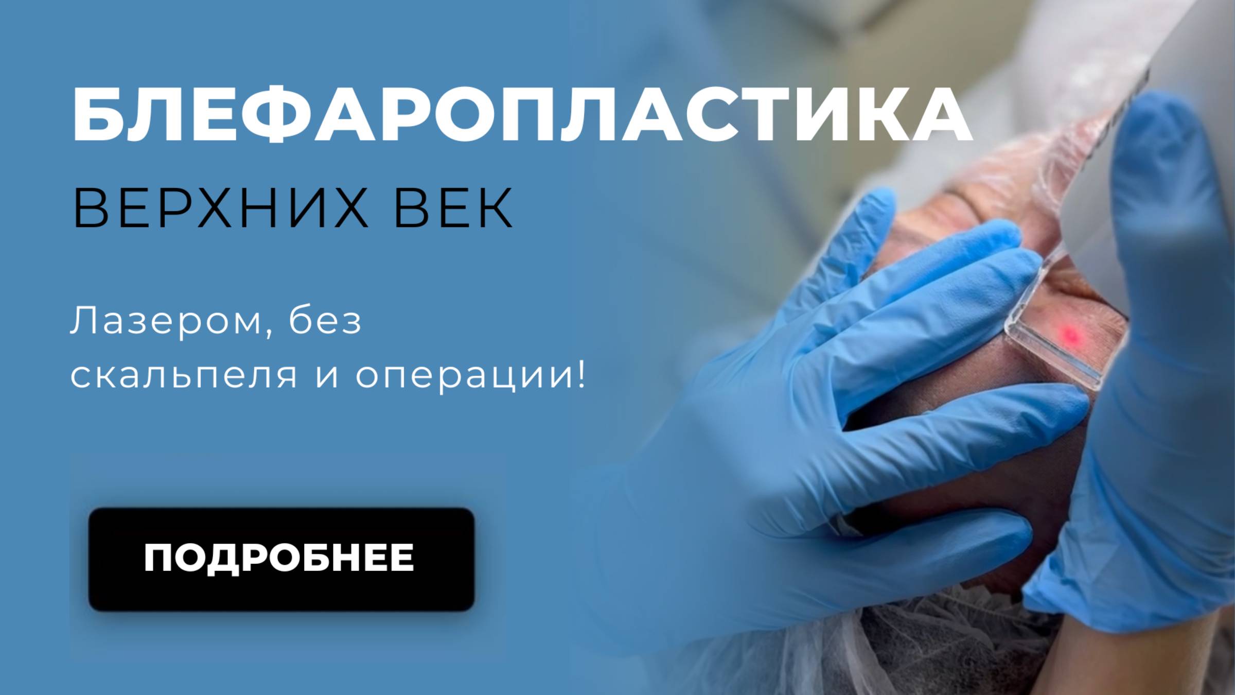 Блефаропластика верхнего века