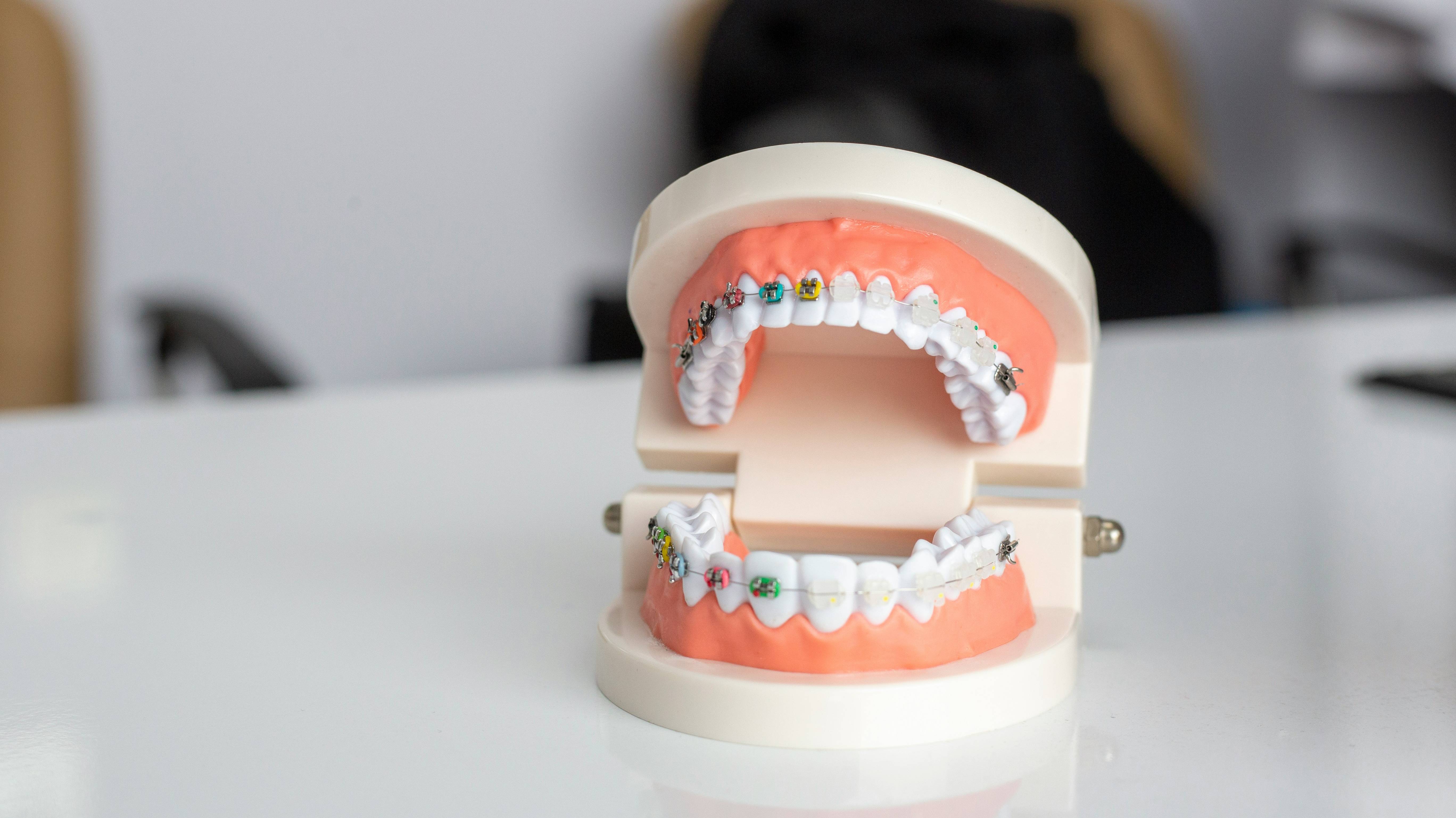 A great offer in SEO for Orthodontist Montreal