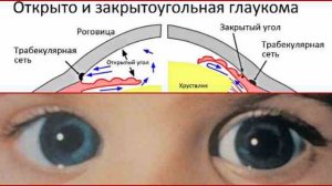 ГЛАУКОМА  анатомия, физиология, клиника, лечение