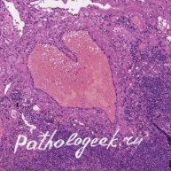Pathologeek Аватар автора