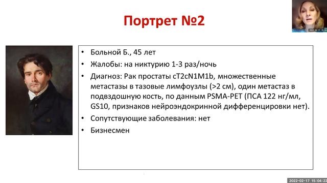 Открытый онкологический консилиум - рак предстательной железы