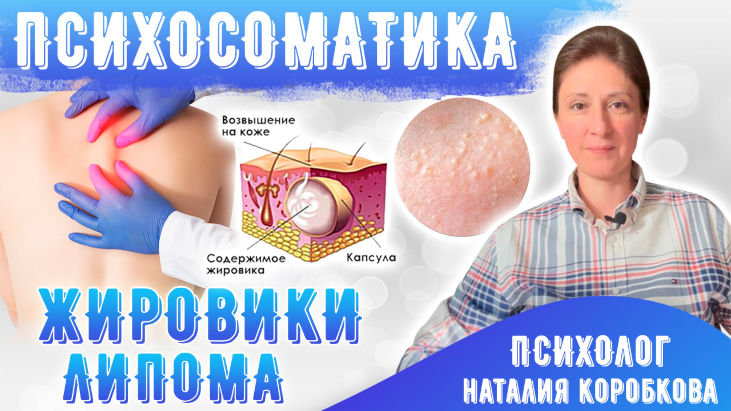 Психосоматика - компьютерный тест