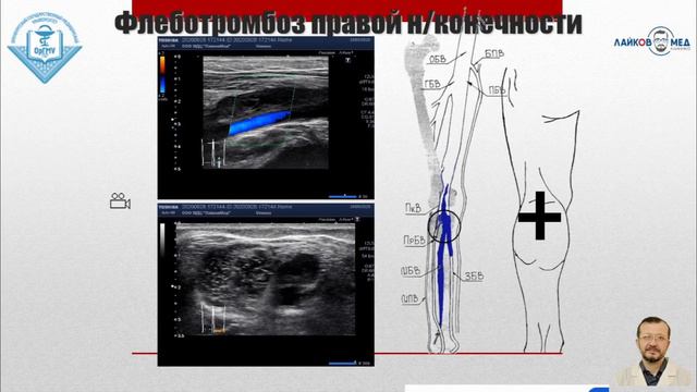 Цикл лекций по УЗИ