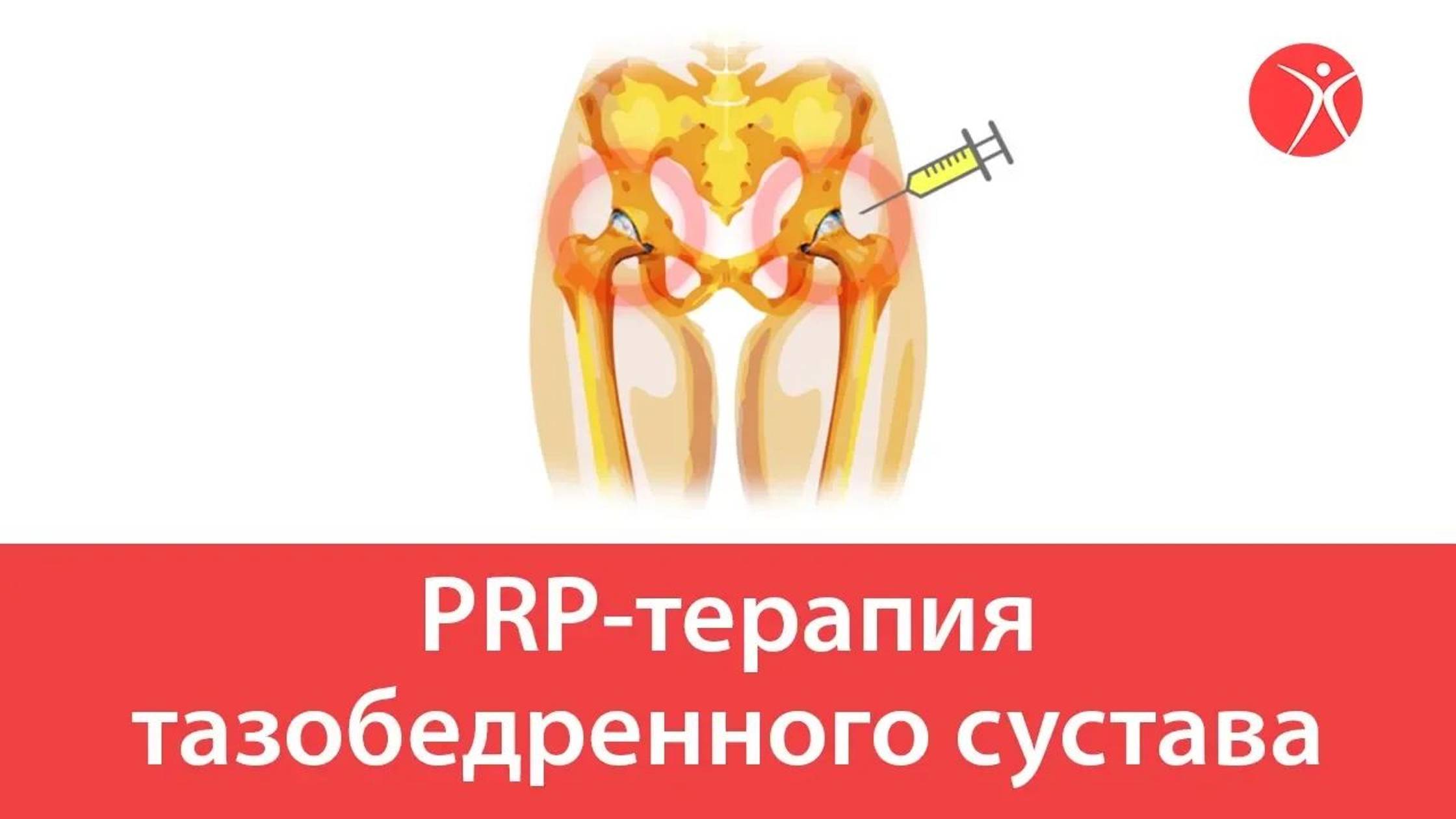 PRP-терапия