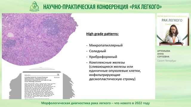 Материалы конференции «Рак легкого» - 2022
