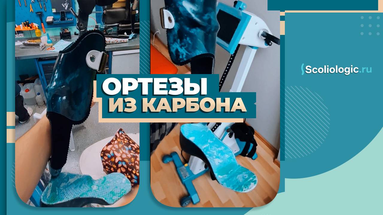 Ортезы, аппараты, туторы