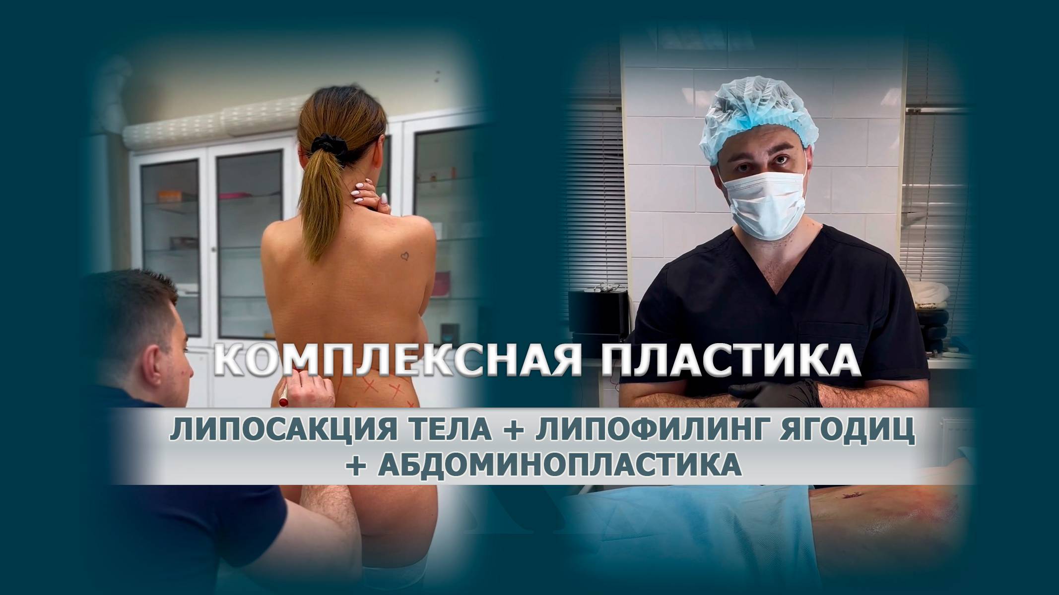 Липосакция