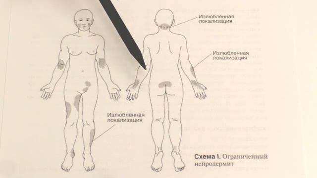 Детский невролог, детская неврология