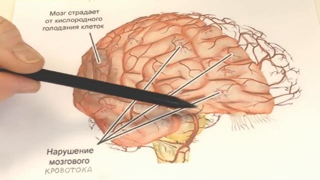 Как помочь при шуме в ушах