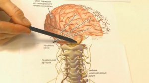 Проблемы мозгового кровотока, нарушение мозгового кровообращения