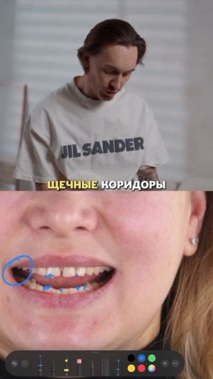 Лечение зубов в Belgravia Dental Studio