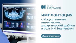 Имплантация зубов в Belgravia Dental Studio