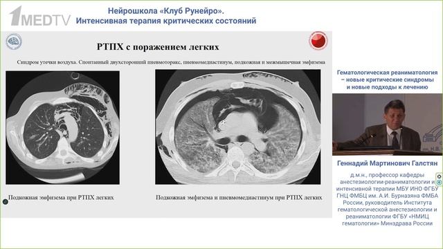 Гемостаз, антикоагулянты, анемия, кровопотеря, трансфузии