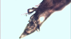 Живой паразит Демодекс под микроскопом. Human Demodex Follicles Mites