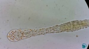 Кольчатые черви (Annelida)