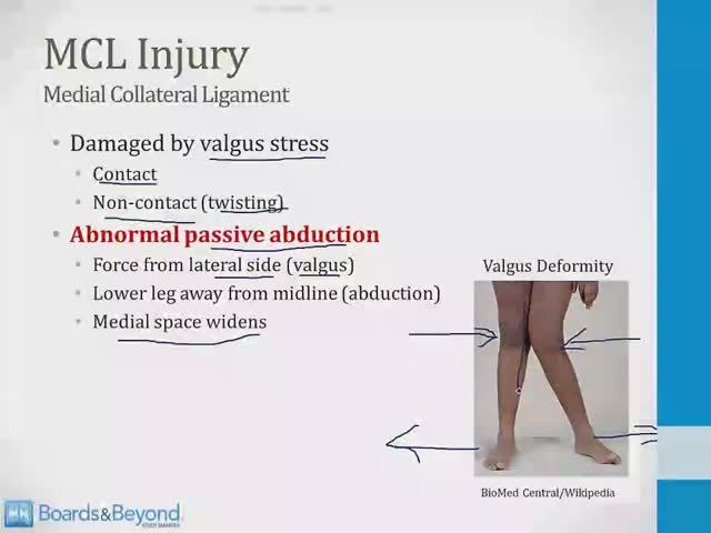 5/17 - ОПОРНО-ДВИГАТЕЛЬНЫЙ АППАРАТ (для USMLE 2022): серия Boards &amp; Beyond - Musculoskeletal (STEP 1)