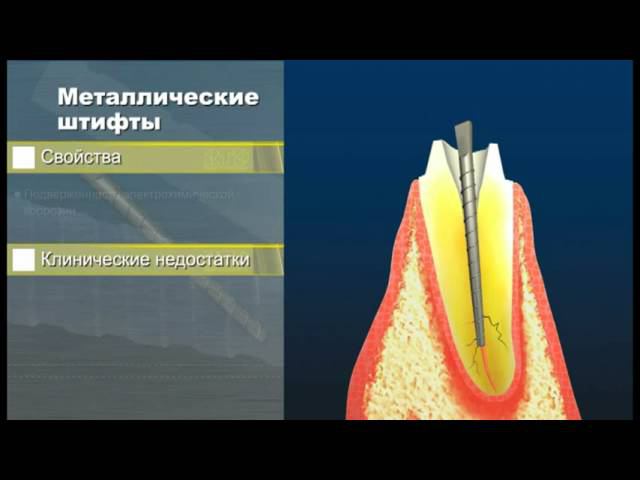 ARKONA | Стоматологические материалы