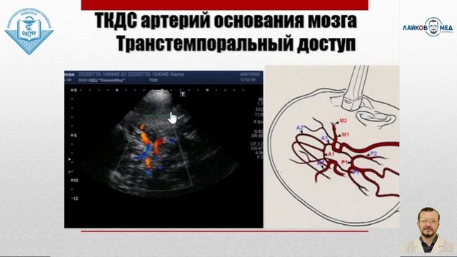 Запись УЗИ исследования на видео