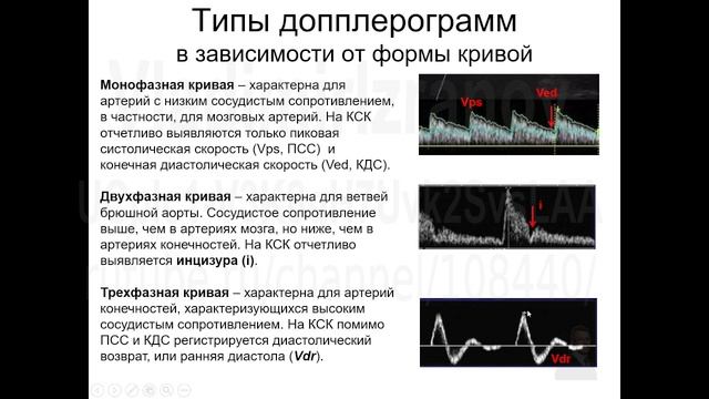 УЗИ сосудов. Допплерография