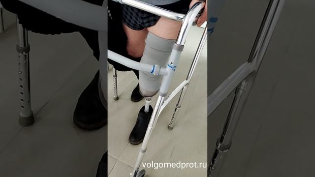 Наши пациенты на протезах. Примерки и ходьба. Отзывы.