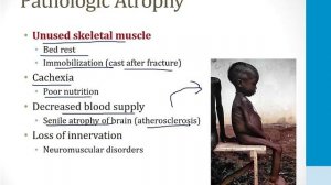 3/17 - ПАТОЛОГИЯ (для USMLE 2022): серия Boards &amp; Beyond - Pathology (STEP 1)