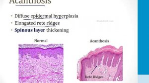 11/17 - ДЕРМАТОЛОГИЯ (для USMLE 2022): серия Boards &amp; Beyond - Dermatology (STEP 1)