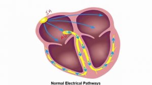 2/16 КАРДИОЛОГИЯ - (2021) USMLE RX - Cardiology