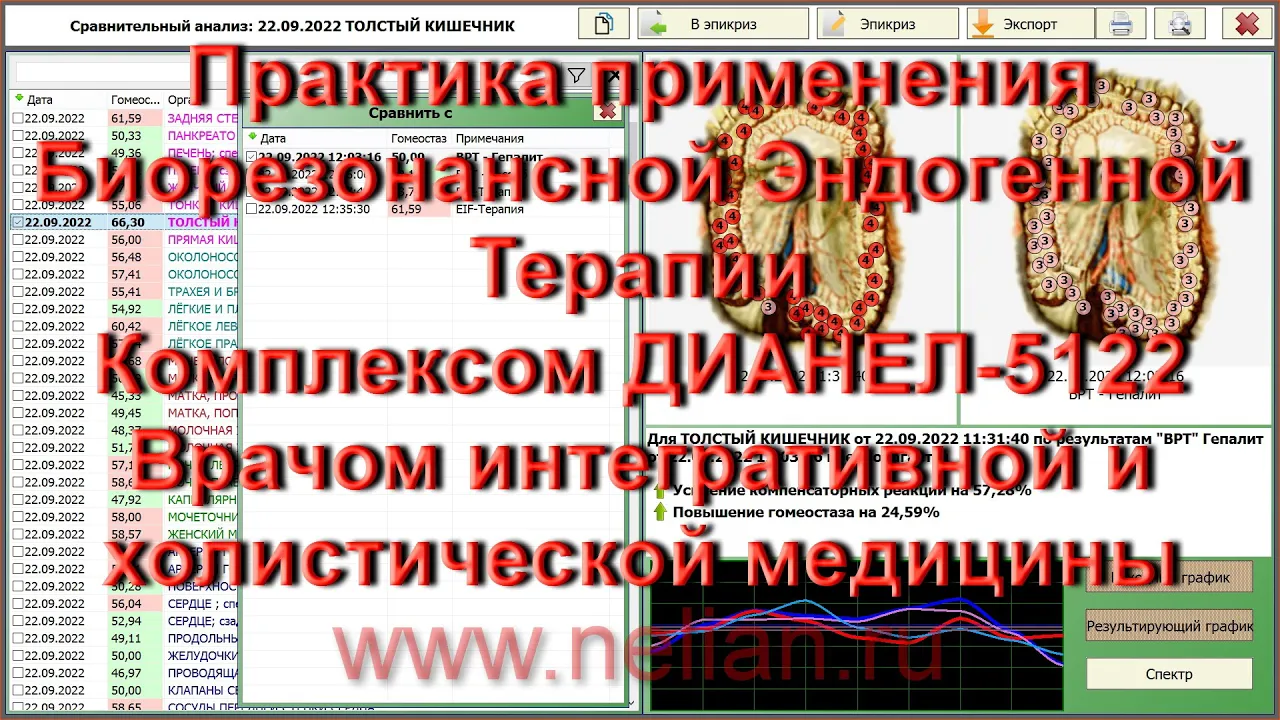 Дианел-2 - Курс обучения работе с прибором биорезонансной диагностики и Биорезонансной Терапии