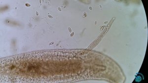 Плоские черви (Platyhelminthes)