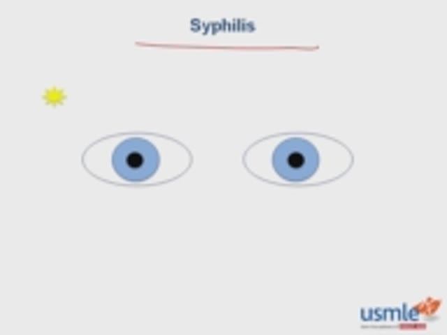 7/16 МИКРОБИОЛОГИЯ - (2021) USMLE RX - Microbiology